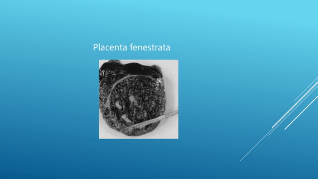 Placenta Pptx