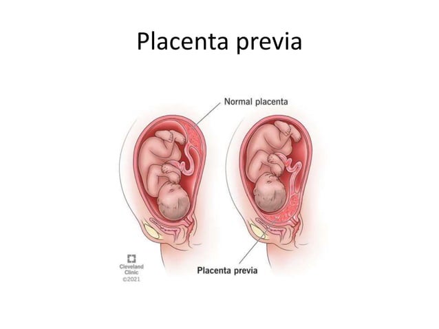 Placenta.ppt