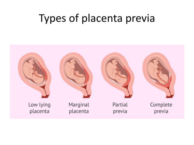 Placenta.ppt