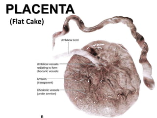 @~PLACENTA.ppt