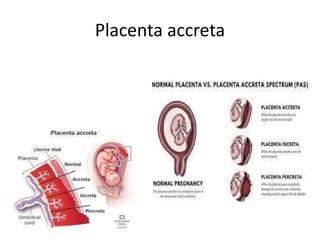 Placenta.ppt