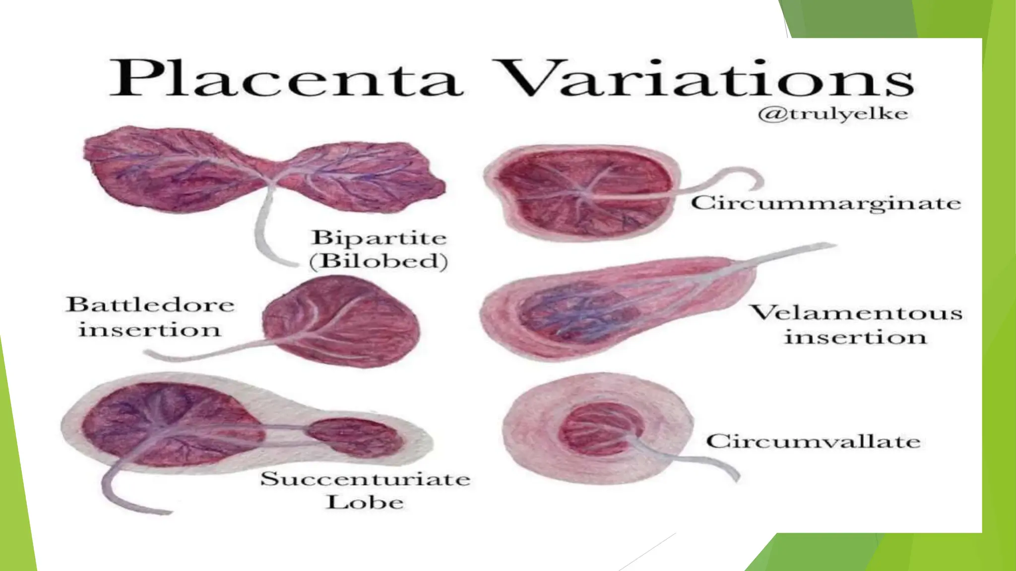 learners will gain knowledge on Placenta.pptx