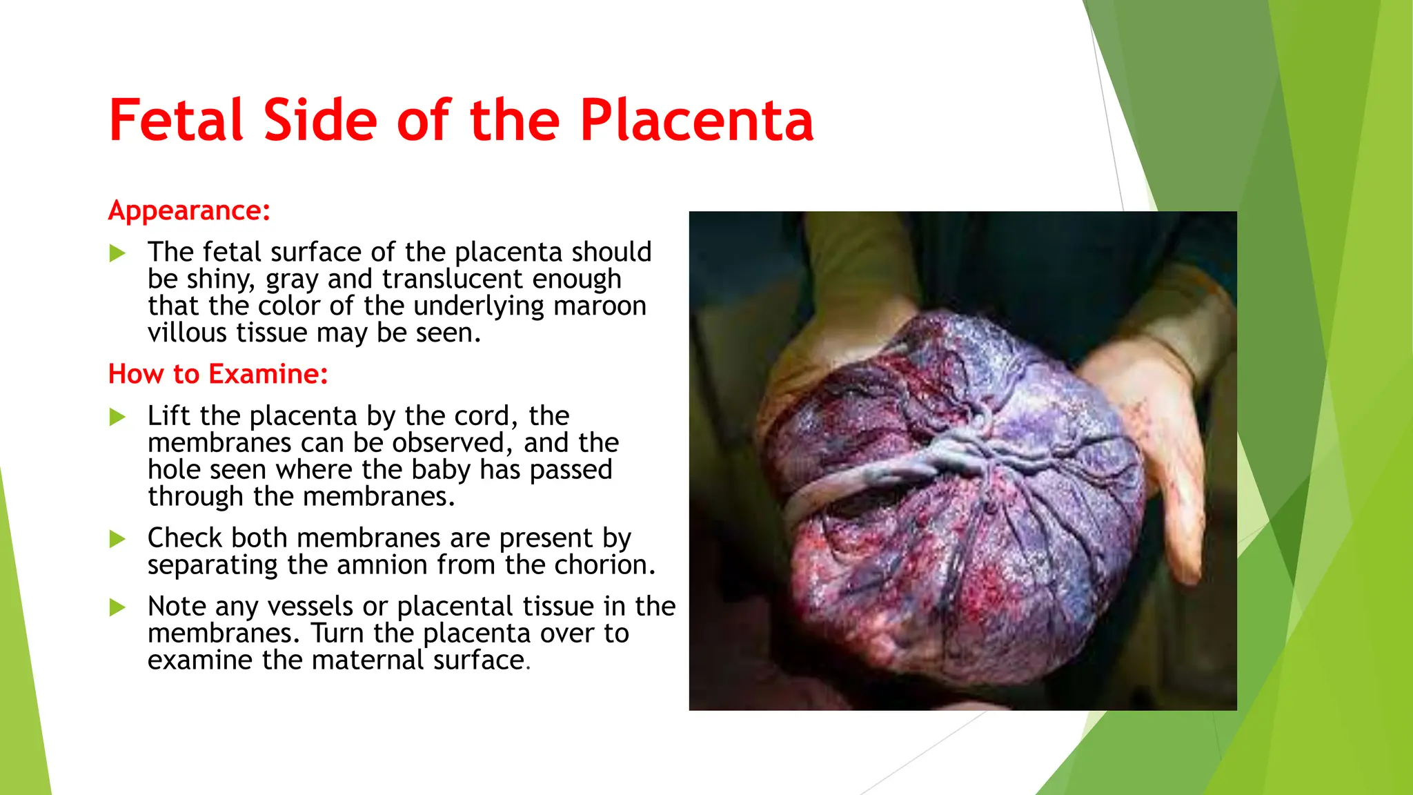 learners will gain knowledge on Placenta.pptx