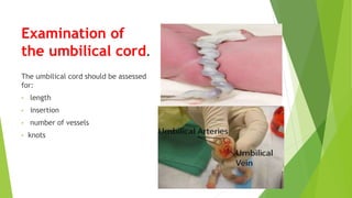 learners will gain knowledge on Placenta.pptx