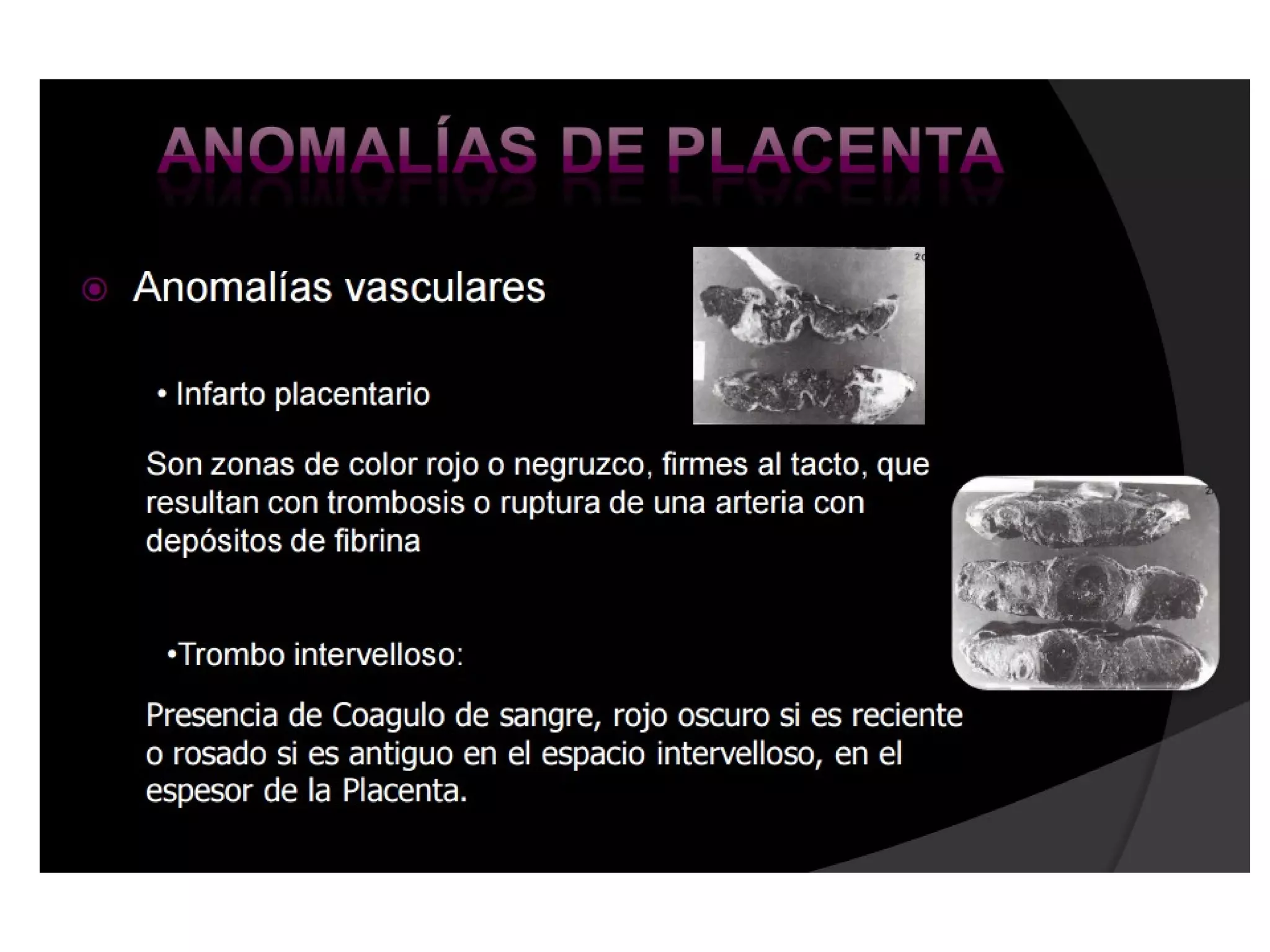 Placenta humana, anatomia, fisiologia y todo lo que deben saber | PPT ...