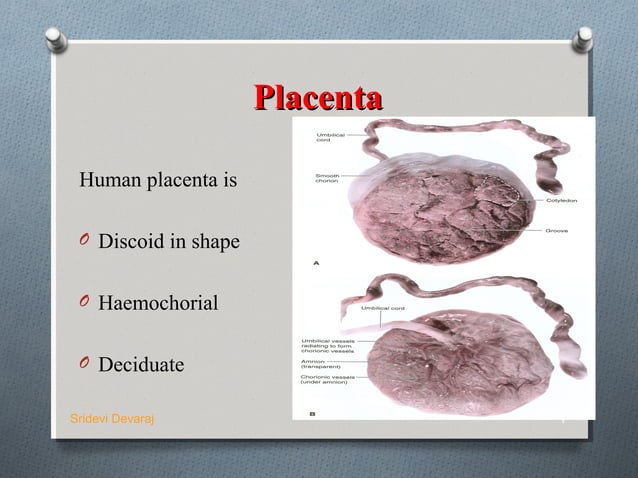 Placenta | PPT | Pregnancy | Reproductive Health