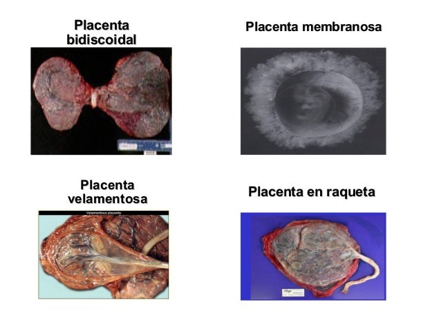 Desarrollo De Placenta