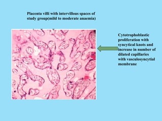 Placenta the wonder organ | PPTX