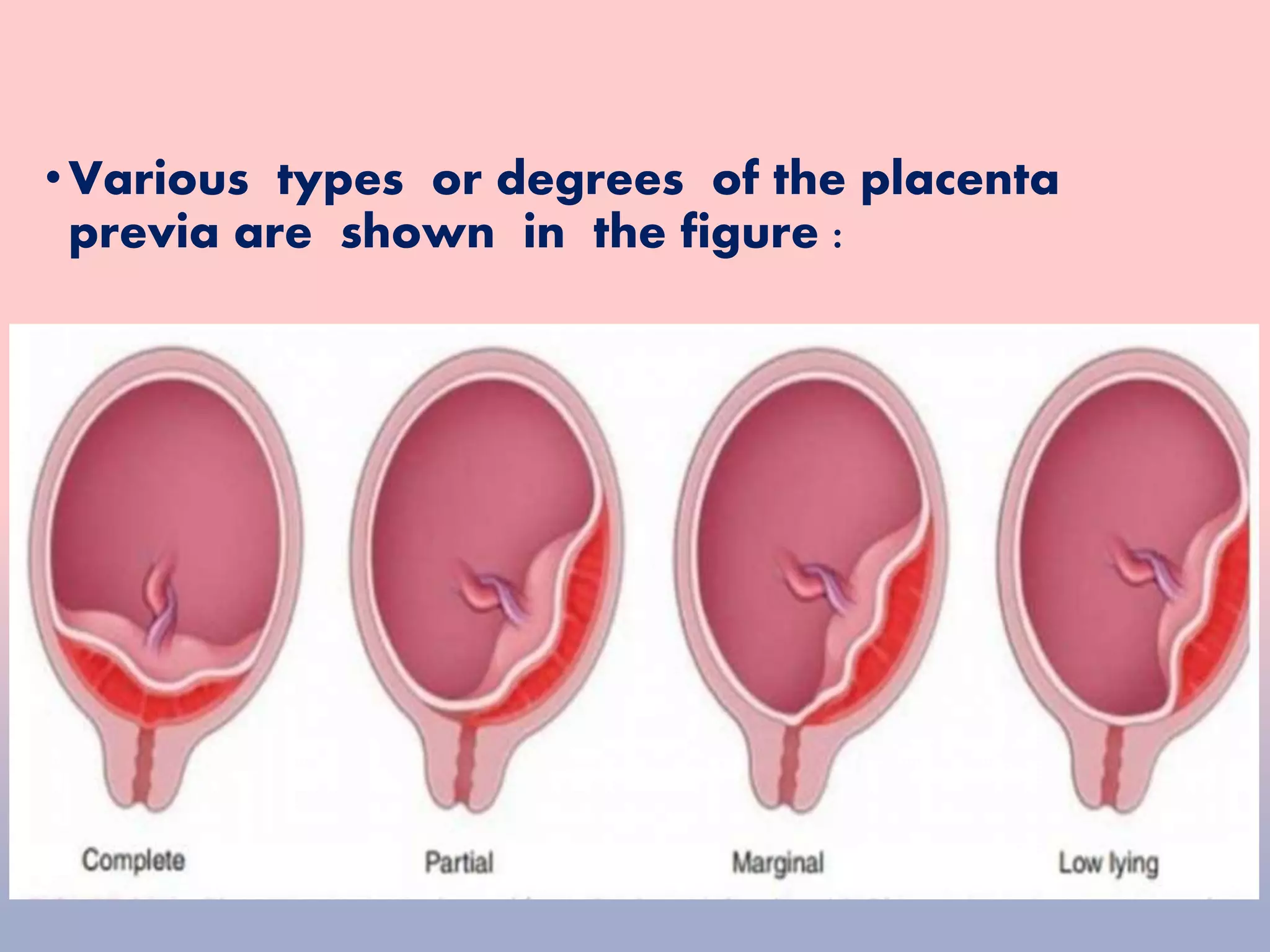 human placenta and its anomalies | PPTX