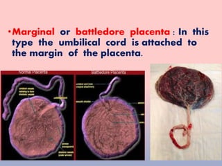 human placenta and its anomalies | PPTX
