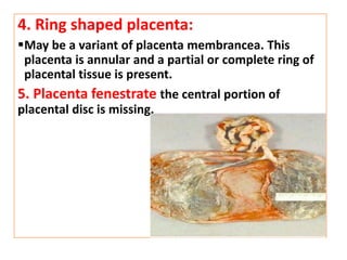 placenta%20MD.pptx