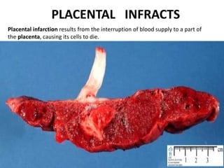 Placenta abnormalities | PPTX