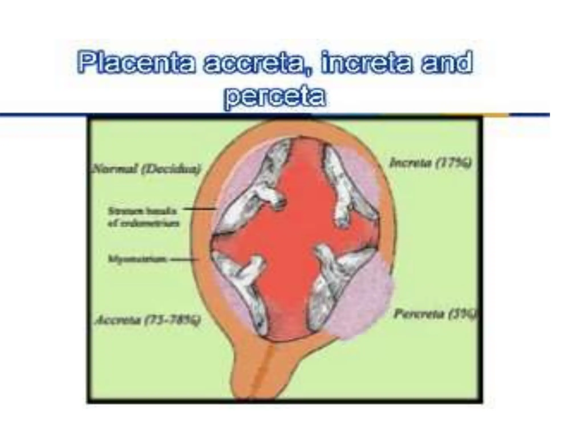 placenta abnormality. it is the topic of obstetrical nursing. | PPTX