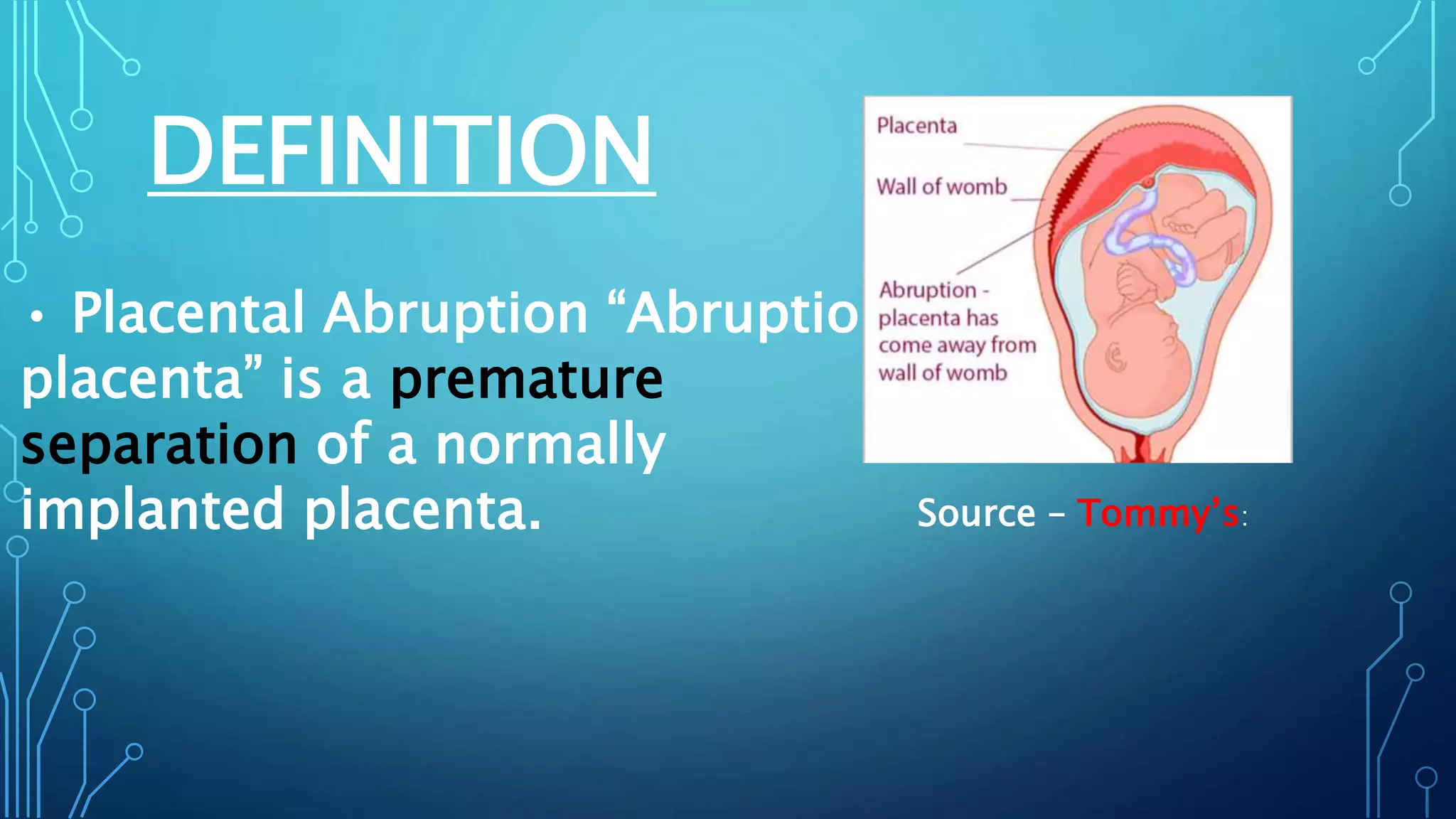 Placenta abruption presentation by YML | PPTX