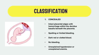 Placenta abruption | PPTX