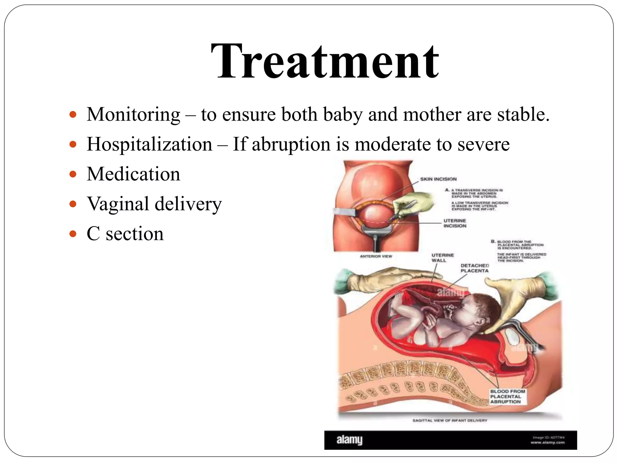 Placenta Abruption.pptx