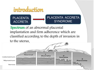 PLACENTA ACCRETA | PPTX