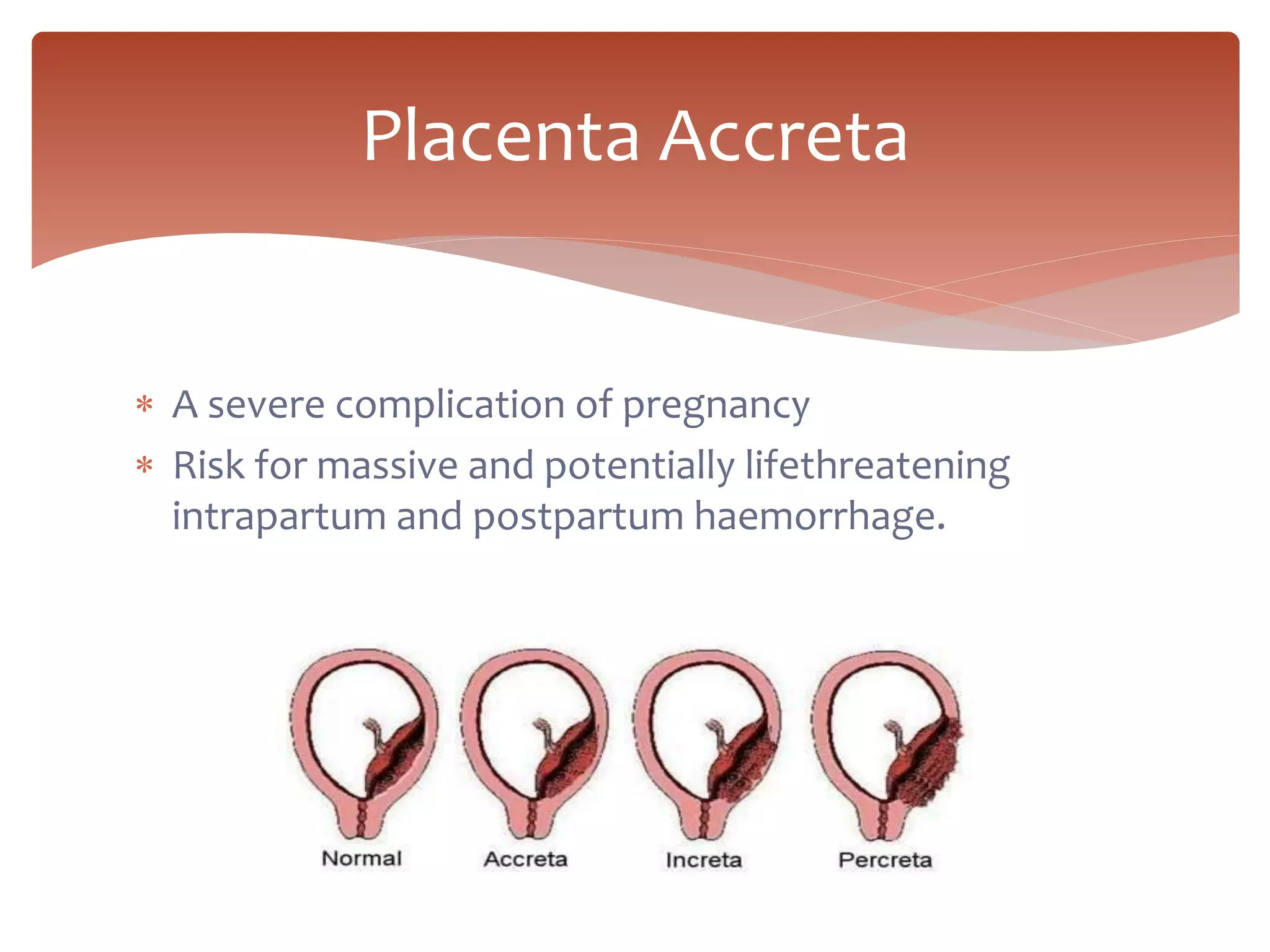 Placenta accreta.pptx
