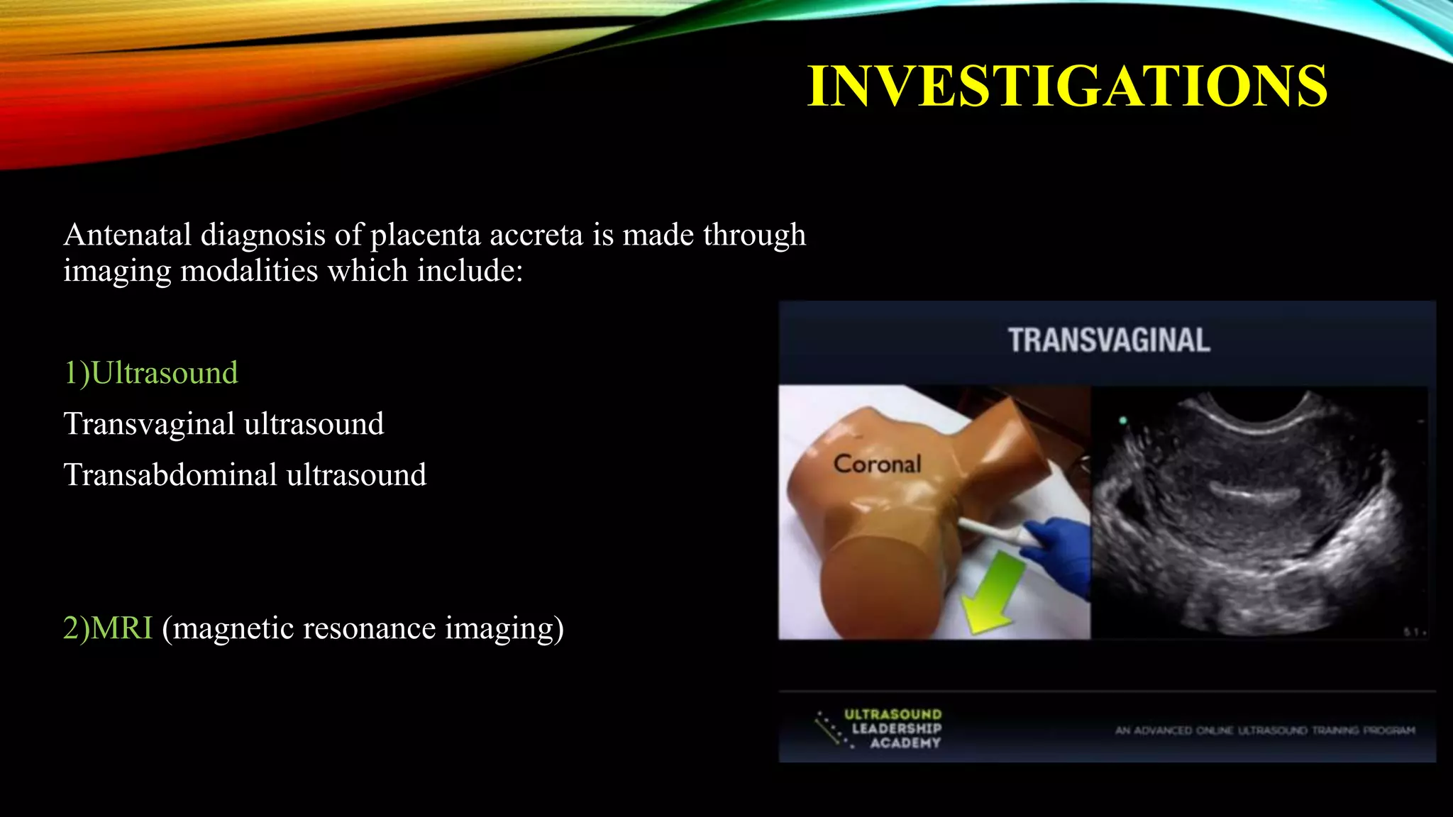 PLACENTA ACCRETA SPECTRUM DISORDERS.pptx