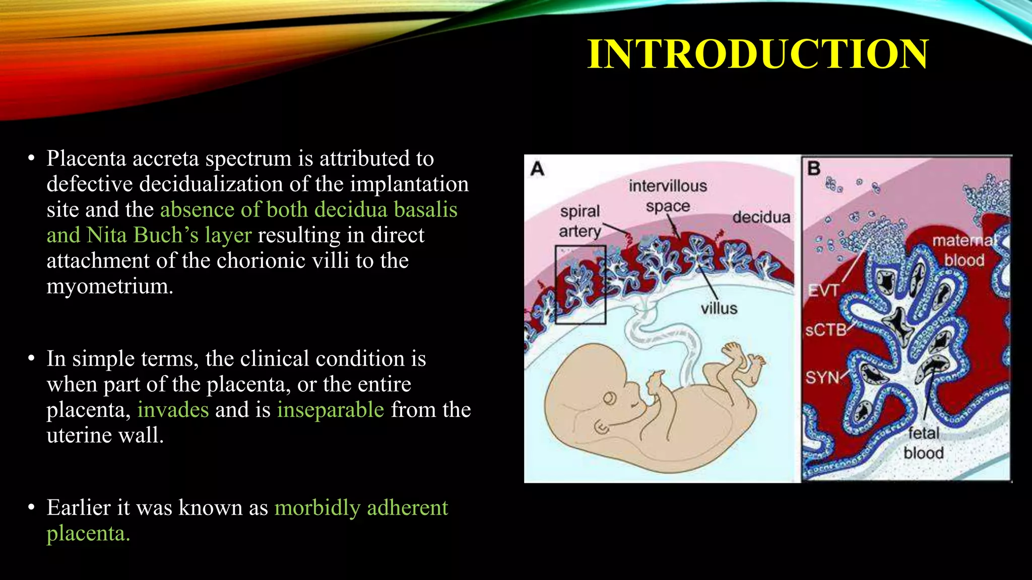 PLACENTA ACCRETA SPECTRUM DISORDERS.pptx