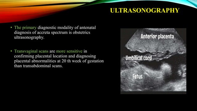 PLACENTA ACCRETA SPECTRUM DISORDERS.pptx