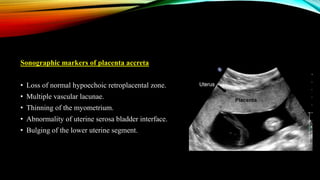 PLACENTA ACCRETA SPECTRUM DISORDERS.pptx