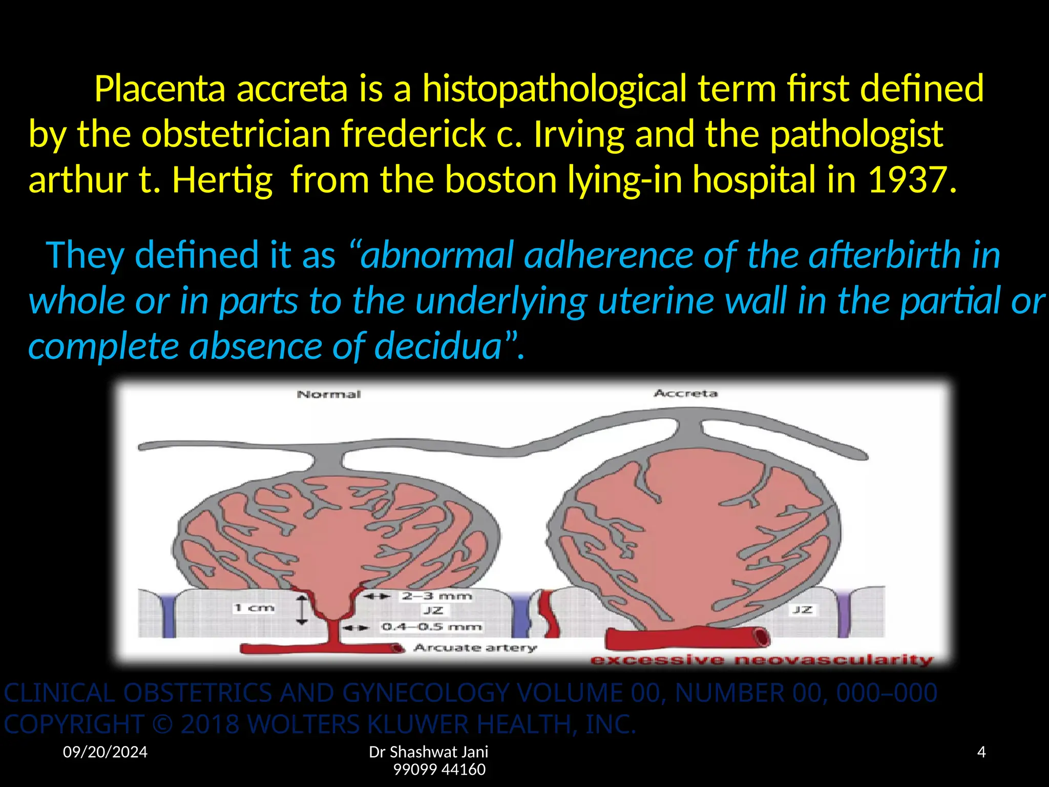 PLACENTA ACCRETA SYNDROME - CLASSIFICATION & RISK ASSESSMENT BY DR ...