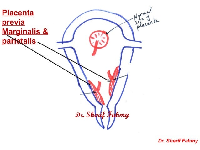 Placenta & Amnion (General Embryology)