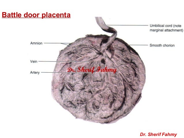 Placenta & Amnion (General Embryology)
