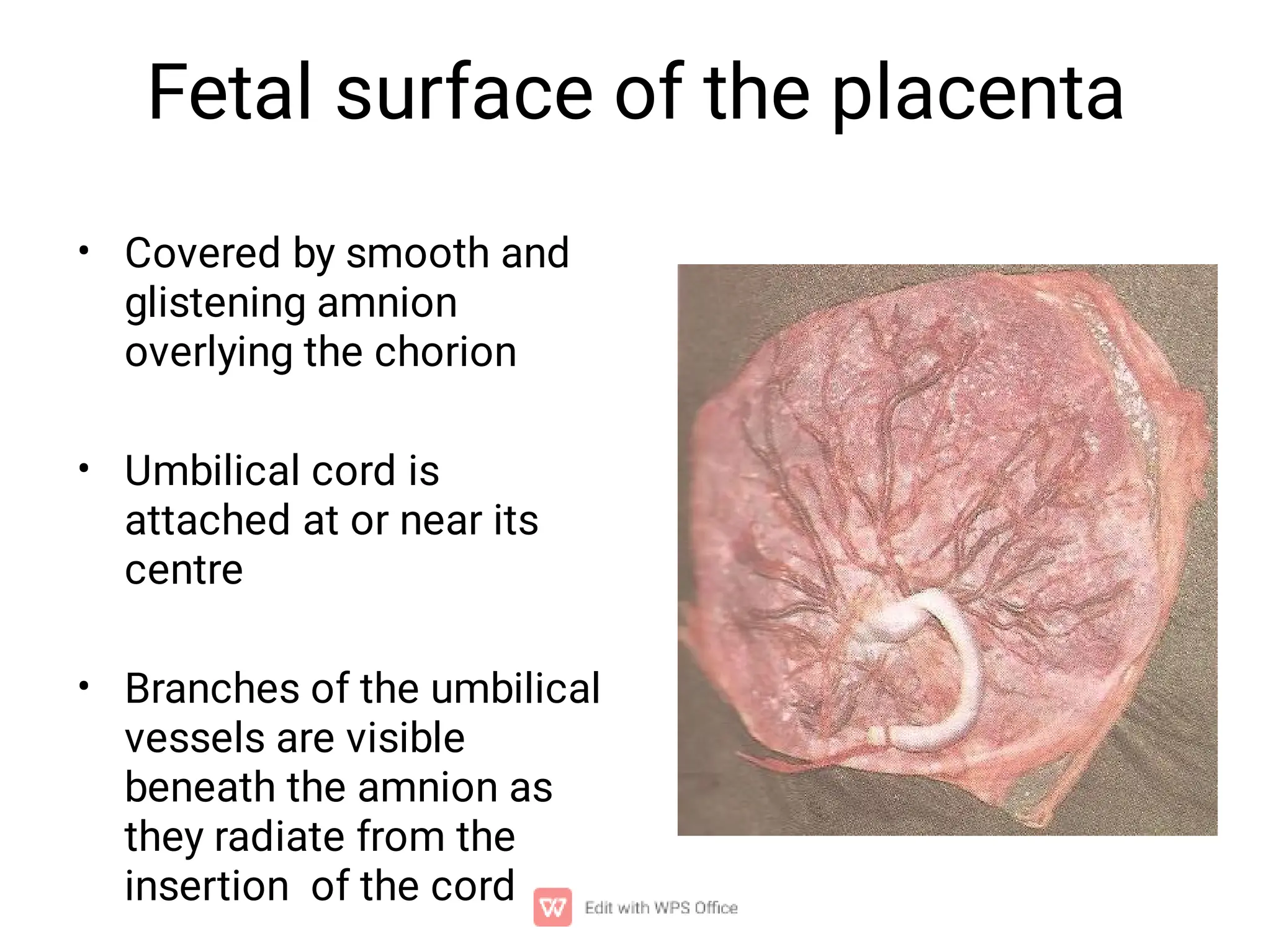 Placenta_and_Amniotic_fluid_Structure_Function.pdf