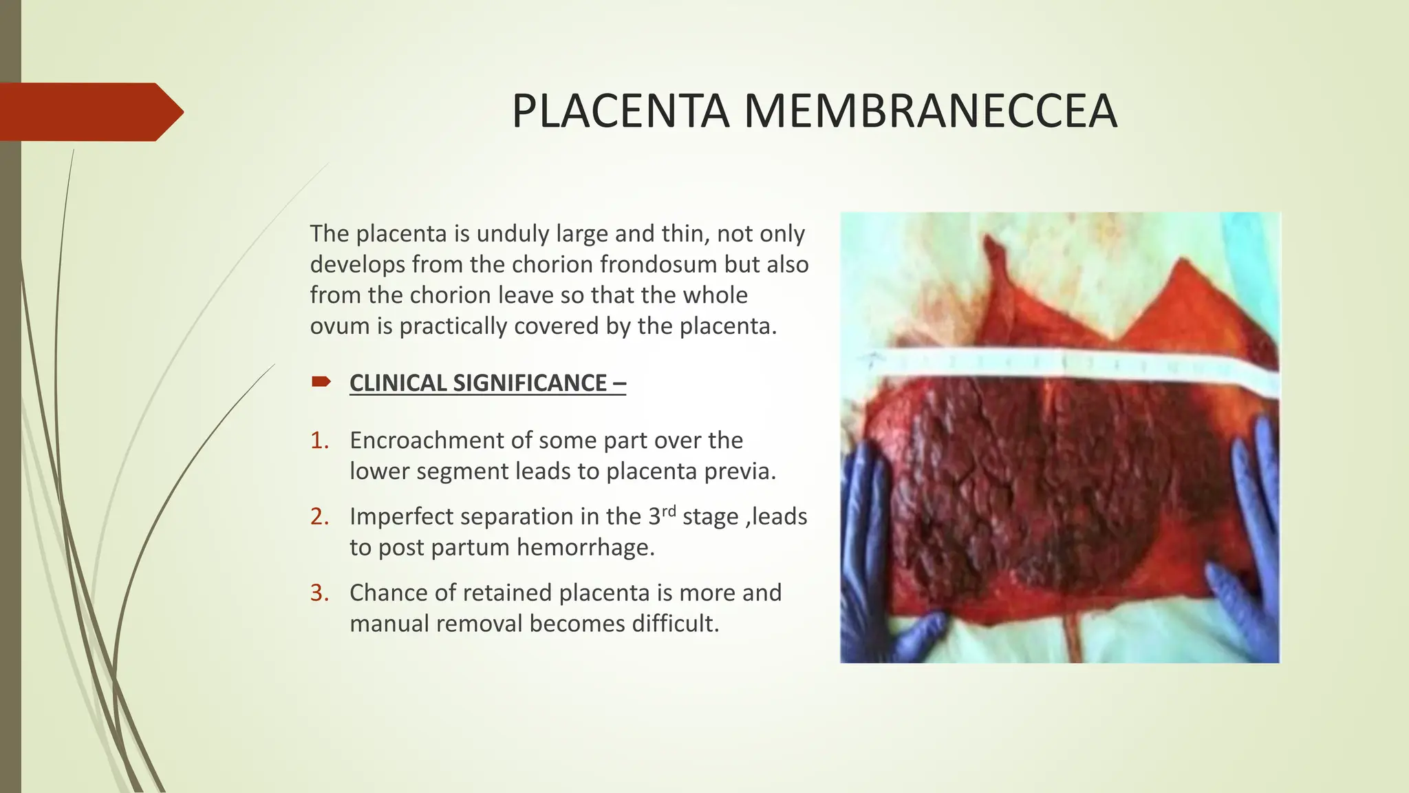 PLACENTA AT TERM PPT for third year GNM student | PPTX