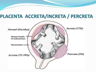 Placenta & cord abnormality | PPTX