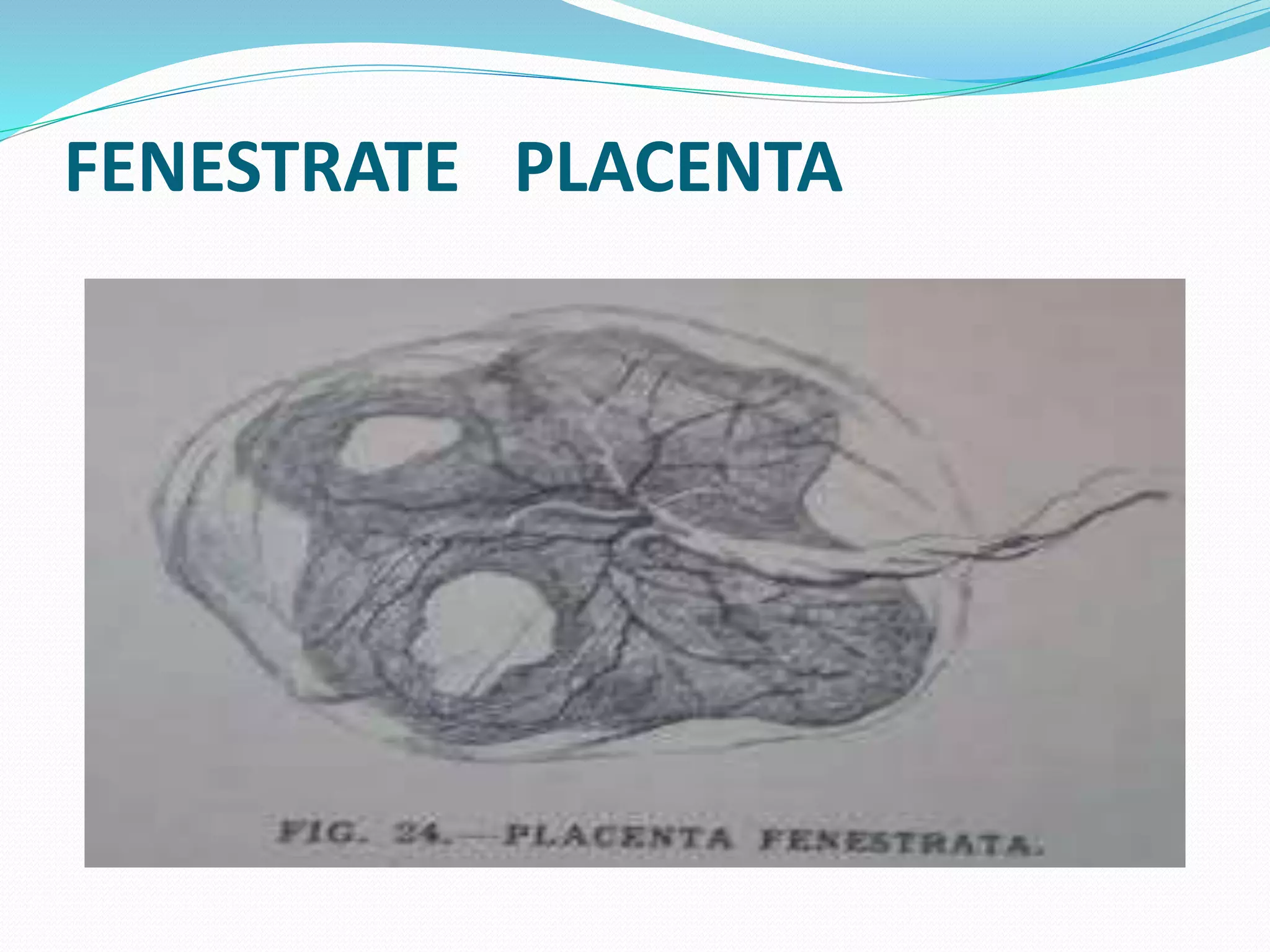Placenta & cord abnormality | PPTX