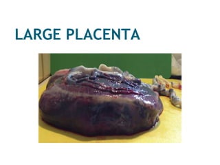 Placenta and cord abnormality | PPTX