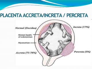 Placenta and cord abnormality | PPT