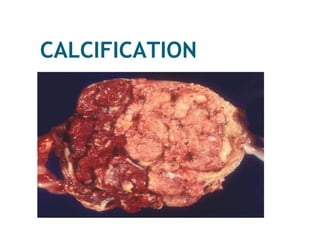 Placenta and cord abnormality | PPTX