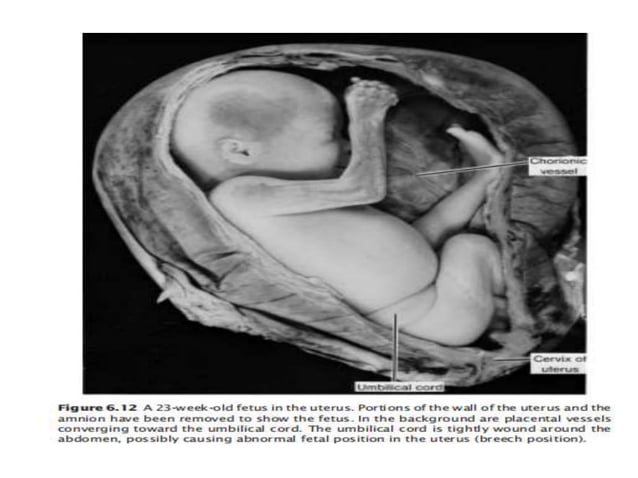Placenta Development ppt By Zeki PH 2016.pptx