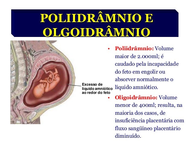 Placenta e membranas cap08