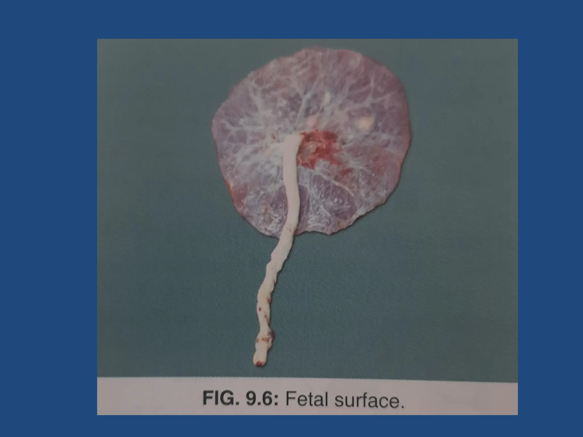Formation and role of placenta in foetal development | PPT