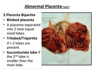 Placenta at term, abnormal placenta and functions of placenta | PDF