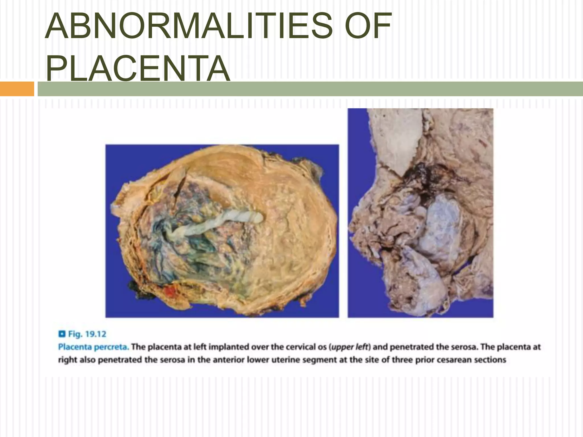 Placenta | PPTX | Pregnancy | Reproductive Health