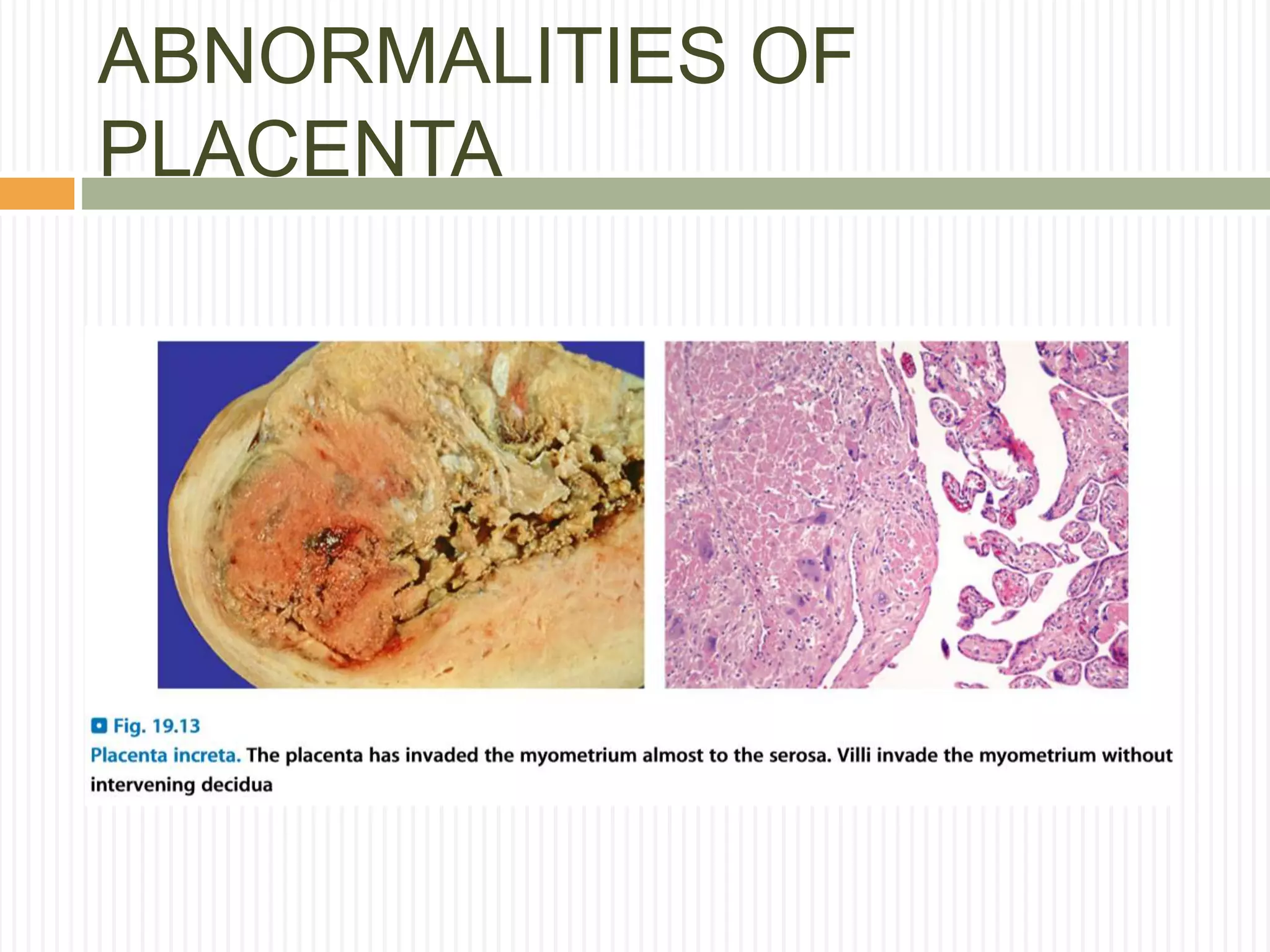 Placenta | PPTX | Pregnancy | Reproductive Health