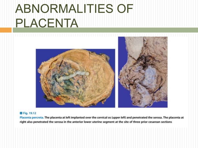 Placenta | PPTX | Pregnancy | Reproductive Health