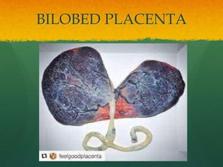 Placental-and-cord-anomalies.pptx