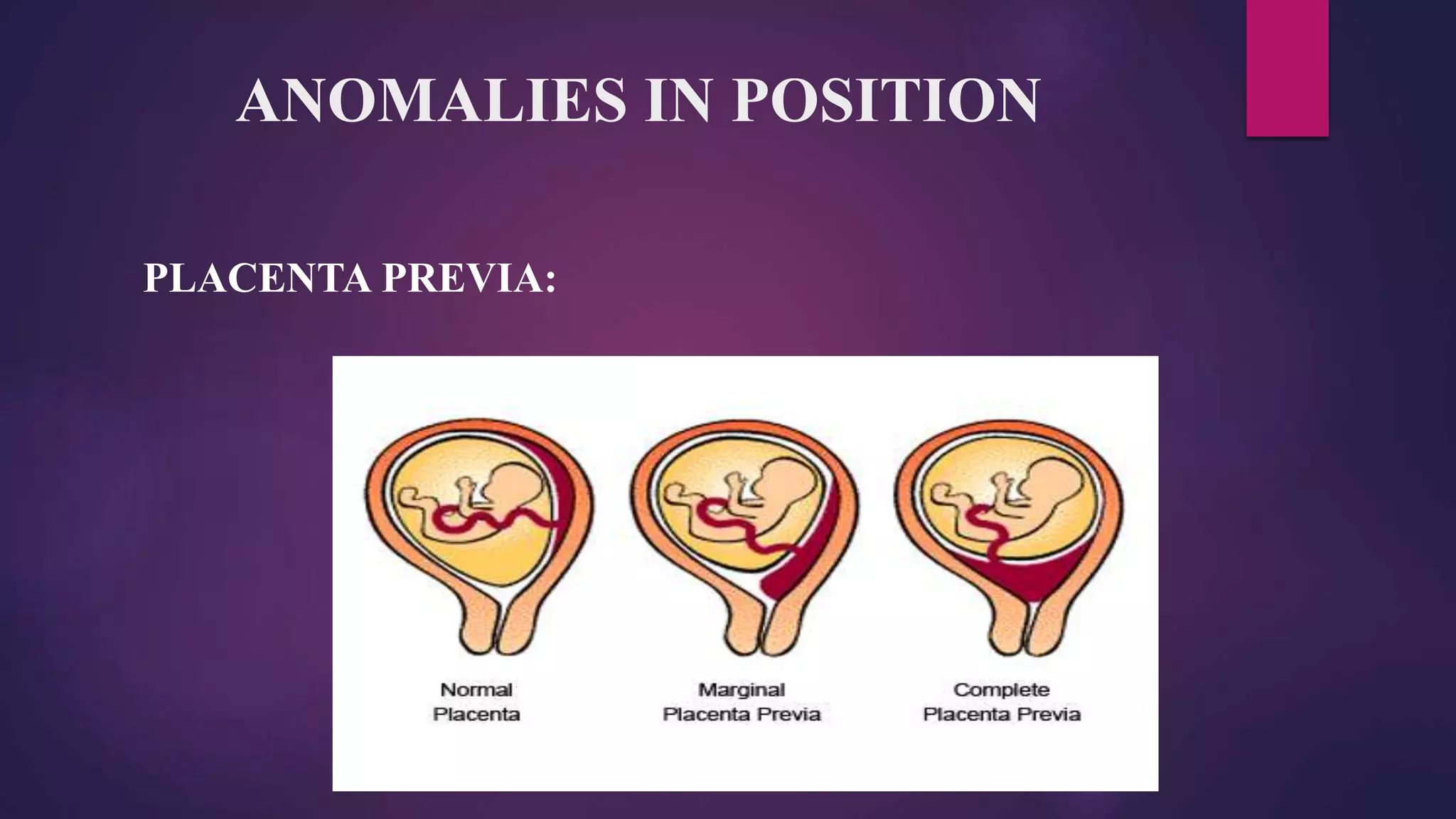 Placental and cord abnormalities | PPTX