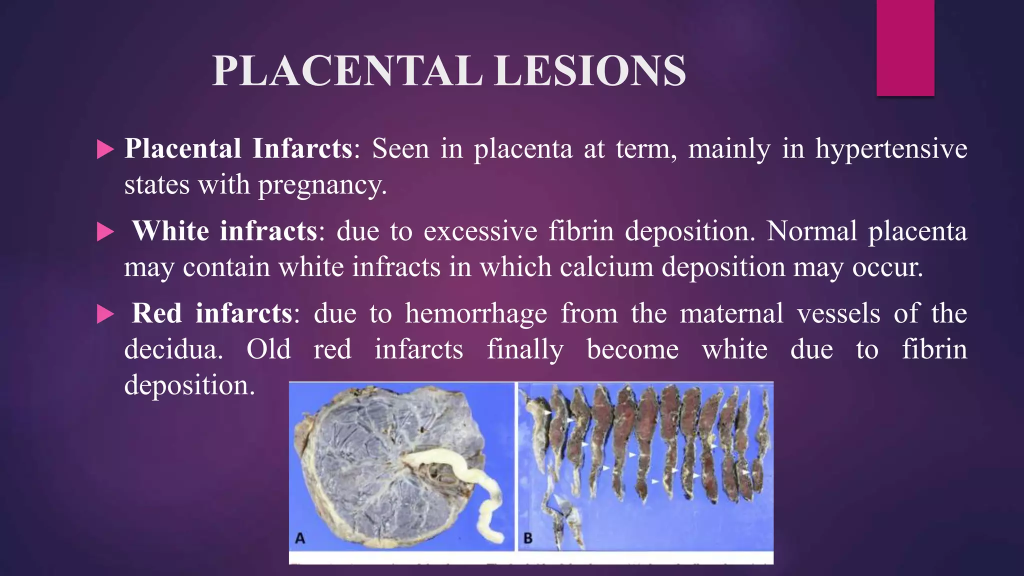 Placental and cord abnormalities | PPTX