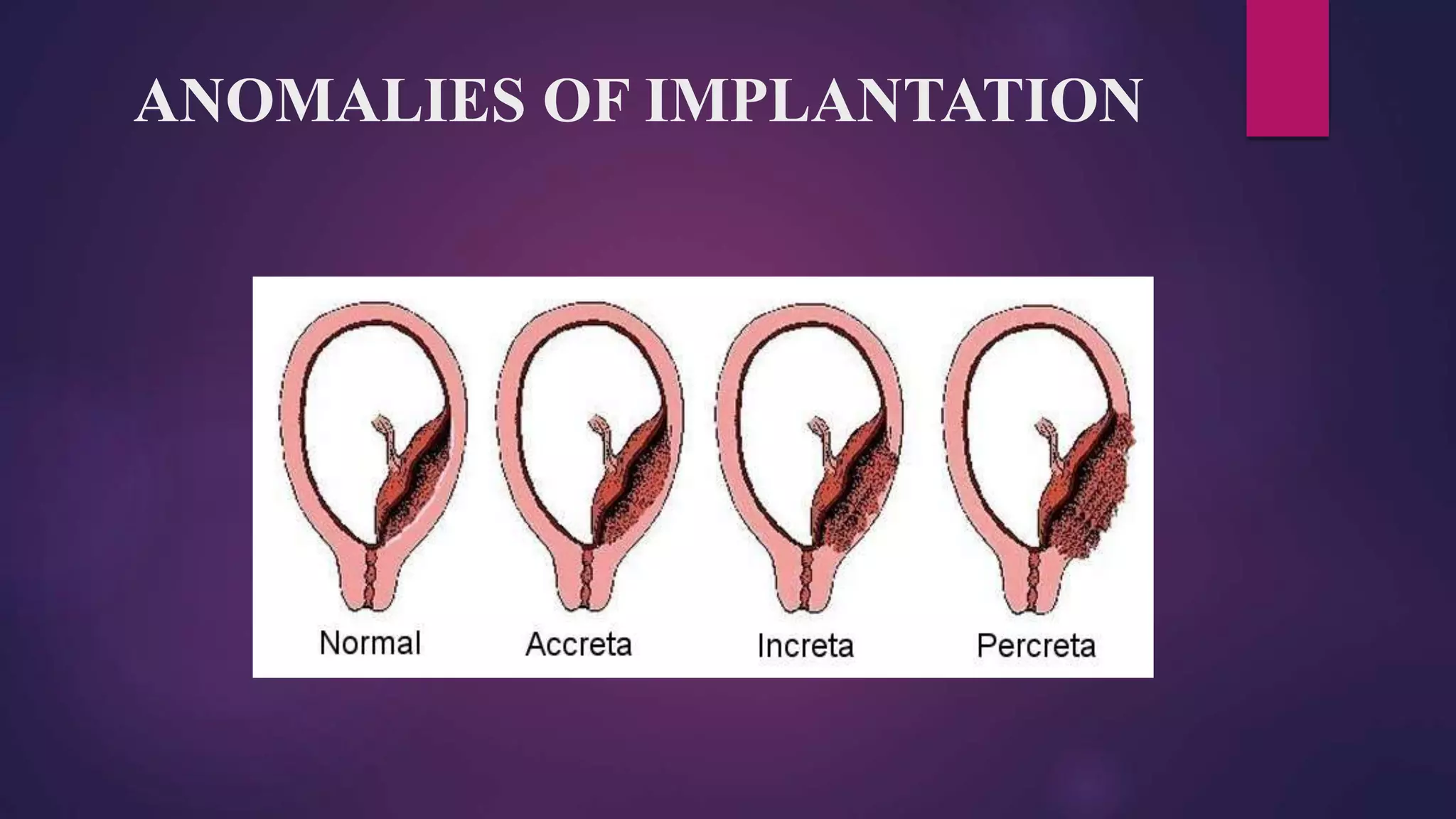 Placental and cord abnormalities | PPTX