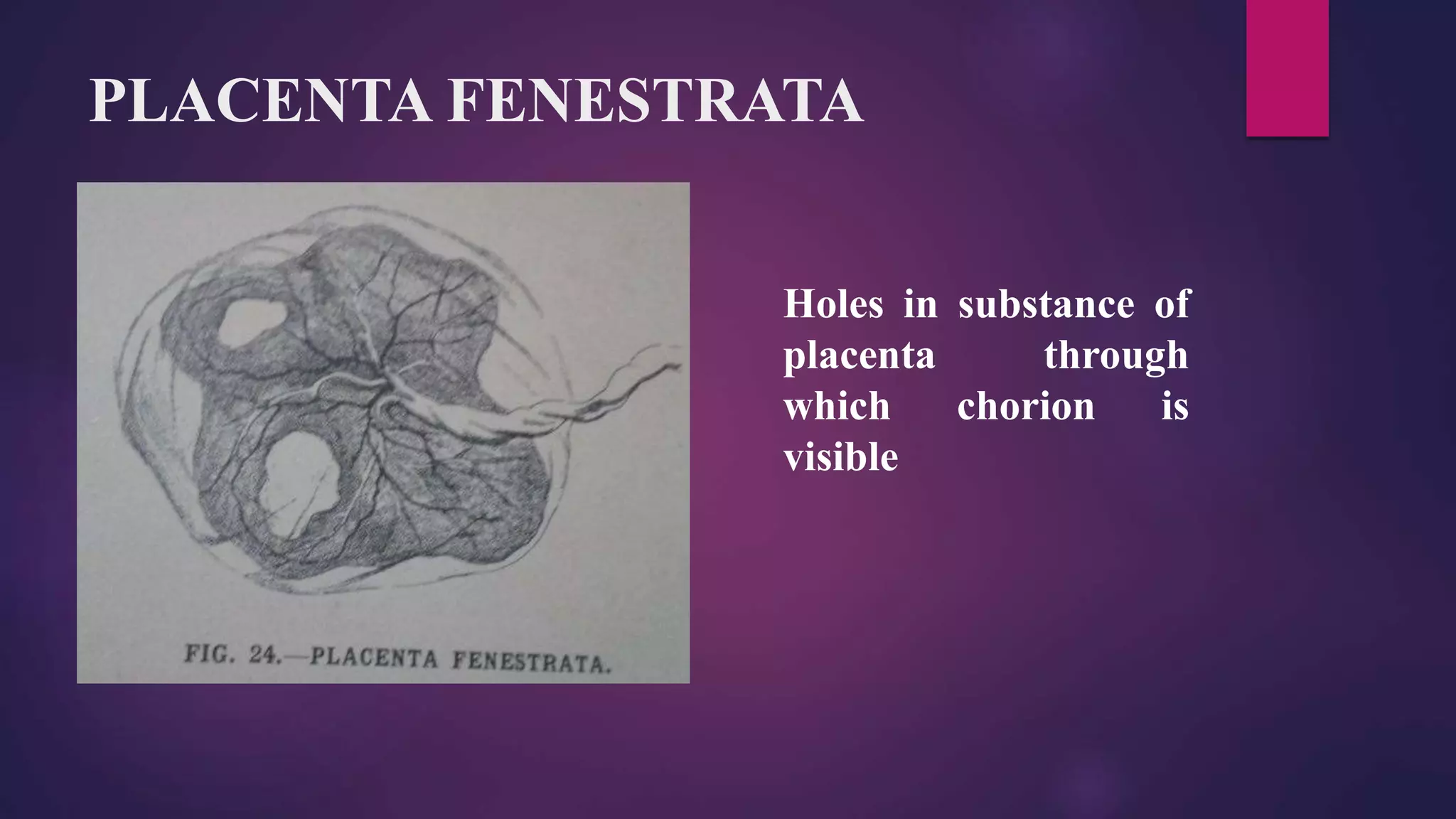 Placental and cord abnormalities | PPTX