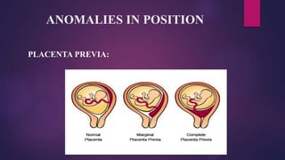 Placental and cord abnormalities | PPTX