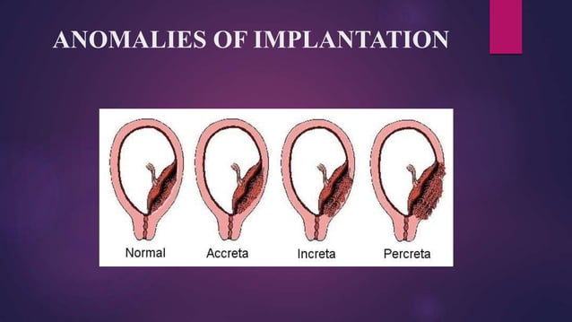 Placental and cord abnormalities | PPTX | Pregnancy | Reproductive Health
